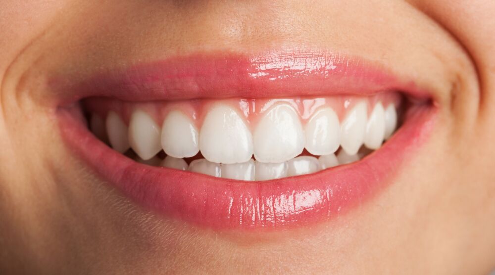 Porcelain Teeth: Definition, Key Benefits and Procedure